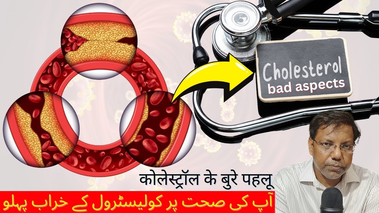 Cholesterol bad aspects - By Dr. Fahim - YouTube