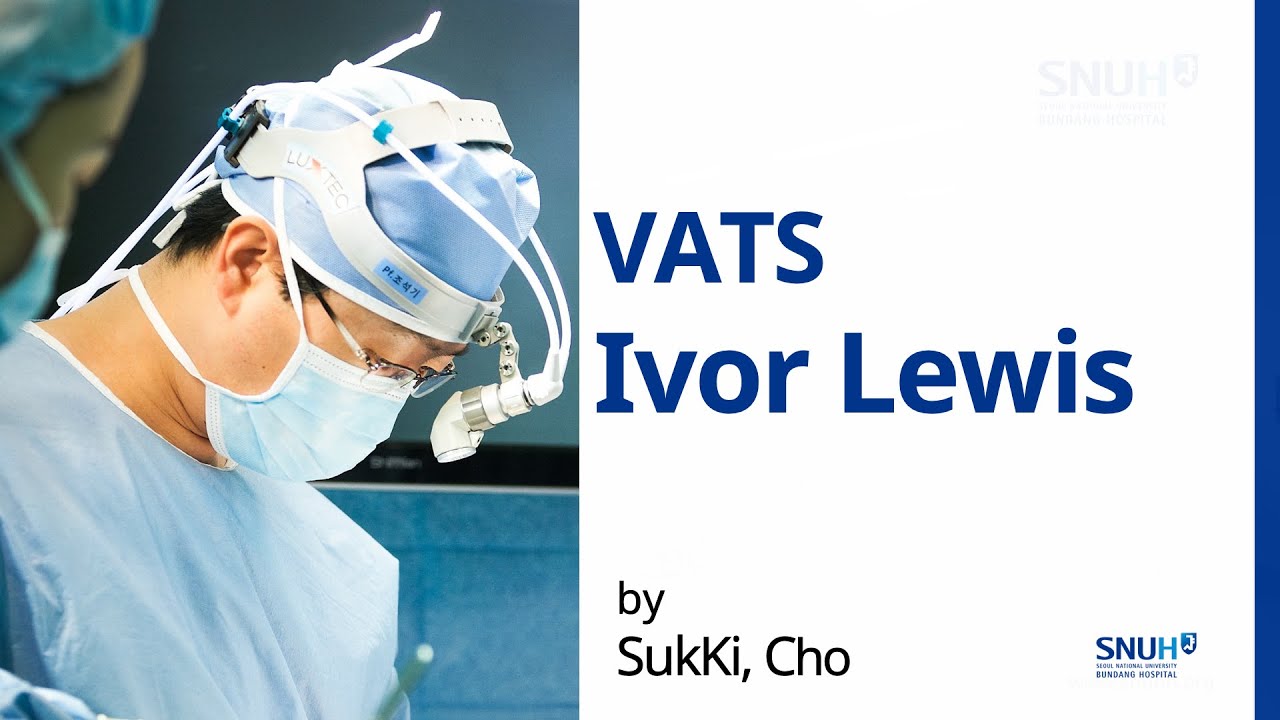 Ivor Lewis VATS (Video-Assisted Thoracoscopic Surgery) - YouTube