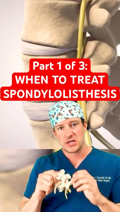 When to Treat Spondy (Part 1 of 3) - YouTube