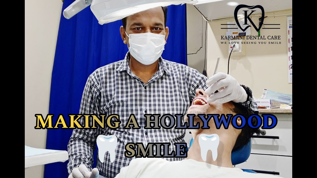 Hollywood Smile.☺| Karmani Dental Care | Dr Rajesh Kumar - YouTube