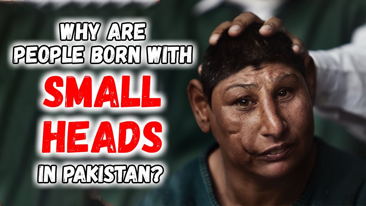 Why are people born with very small heads in Pakistan? Creepy facts ...