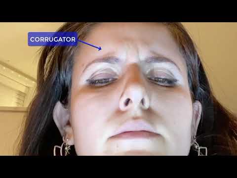 Corrugator vs. Procerus - YouTube