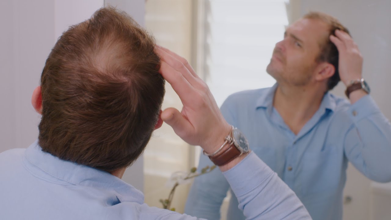 Fill in Balding Crown with Nut Job Hair Fibres 30sec - YouTube