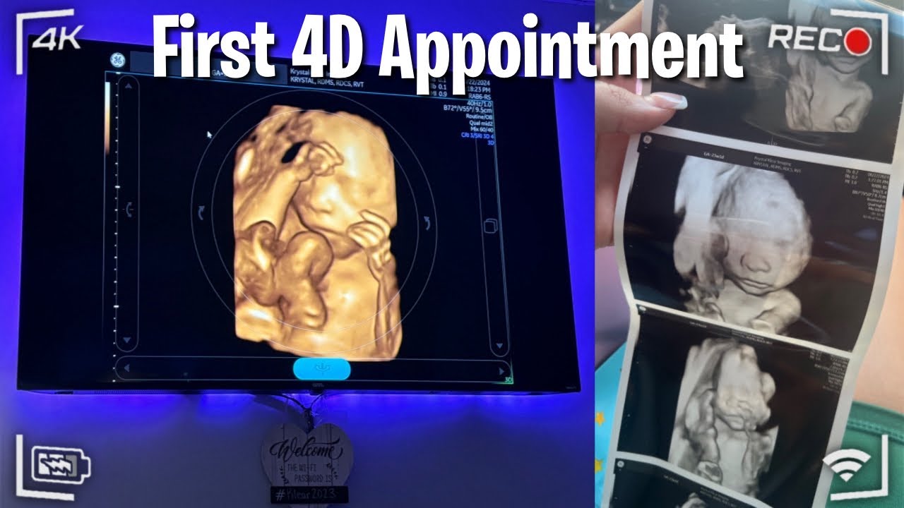 SEEING Our BABY in 4D For The FIRST TIME!! - YouTube