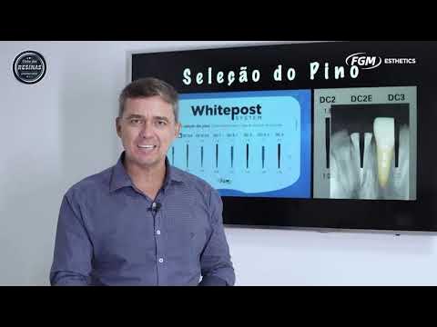 Você sabe qual pino de fibra de vidro usar? O Dr. Leonardo Muniz ...