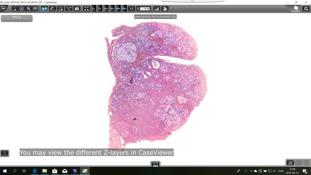 3DHISTECH - Pannoramic Scanner Software 2.1 Tutorial - Z-Stack Flash ...