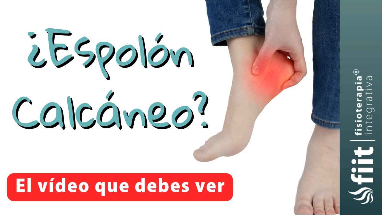 Lo Que Nadie Te Ha Contado Sobre el Tratamiento del Espolón Calcáneo ...
