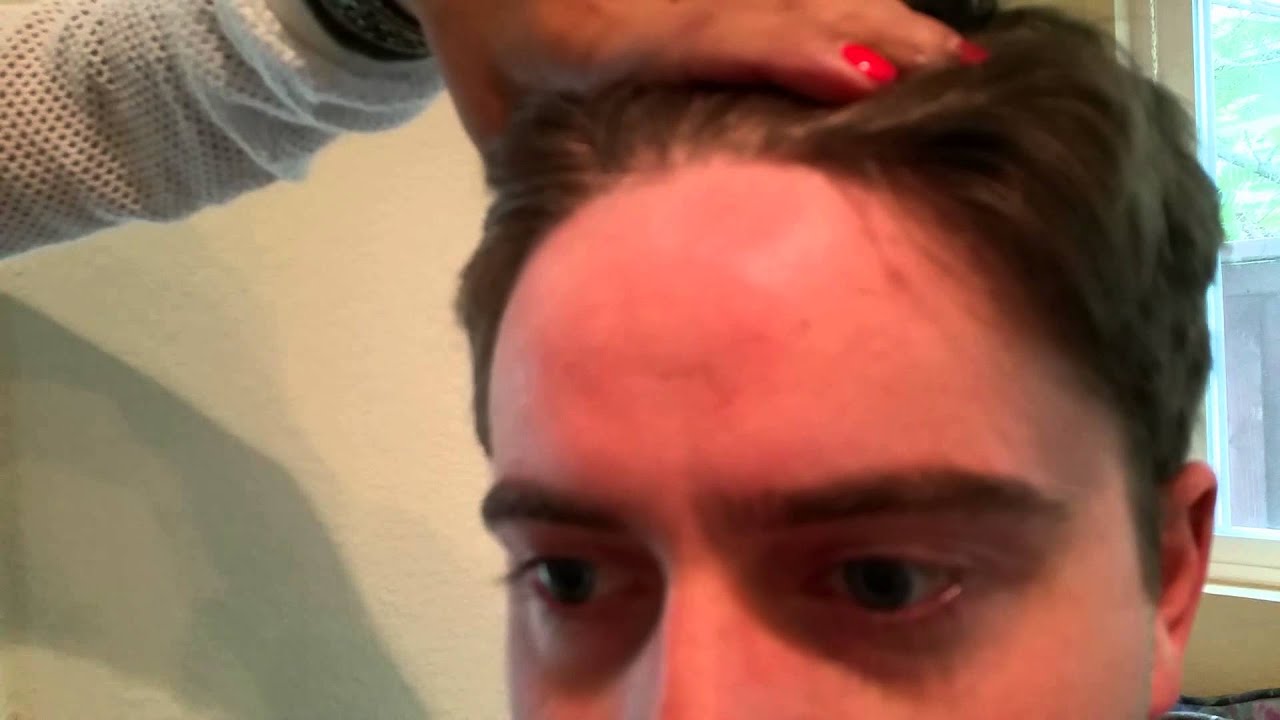 Instantly Ageless! Special Technique for Forehead! - YouTube