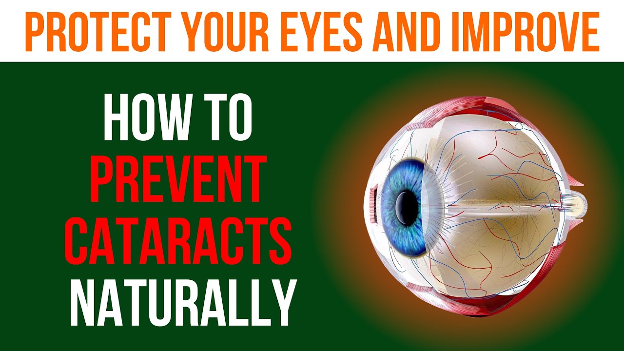 How to Prevent Cataracts Naturally | Protect Your Eyes & Improve Vision ...