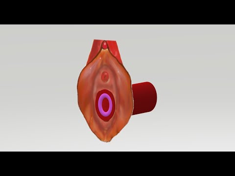 Kızlık Zarı Kanaması (İlk Gece Kanaması) Olmaması - Op. Dr. Funda Yazıcı Erol