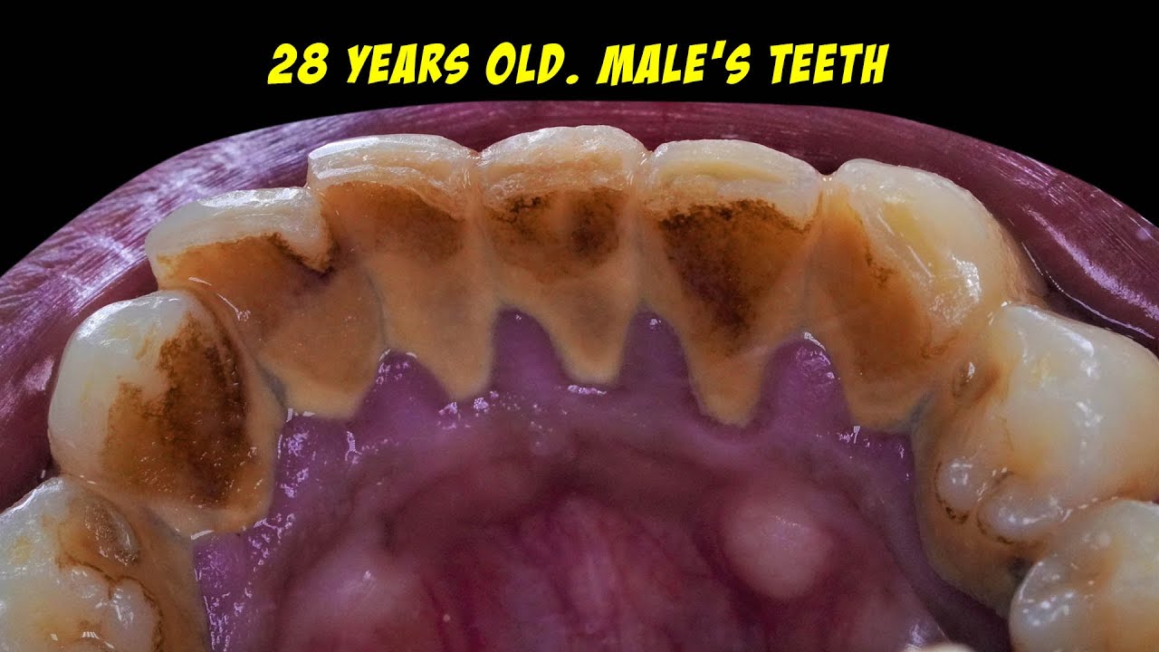 Dental Hygiene Is An Obligation, Don’t Be Lazy To Brush Your Teeth ...