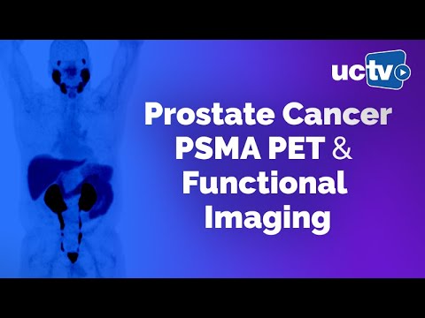 Prostate Cancer: PSMA PET and Functional Imaging - YouTube