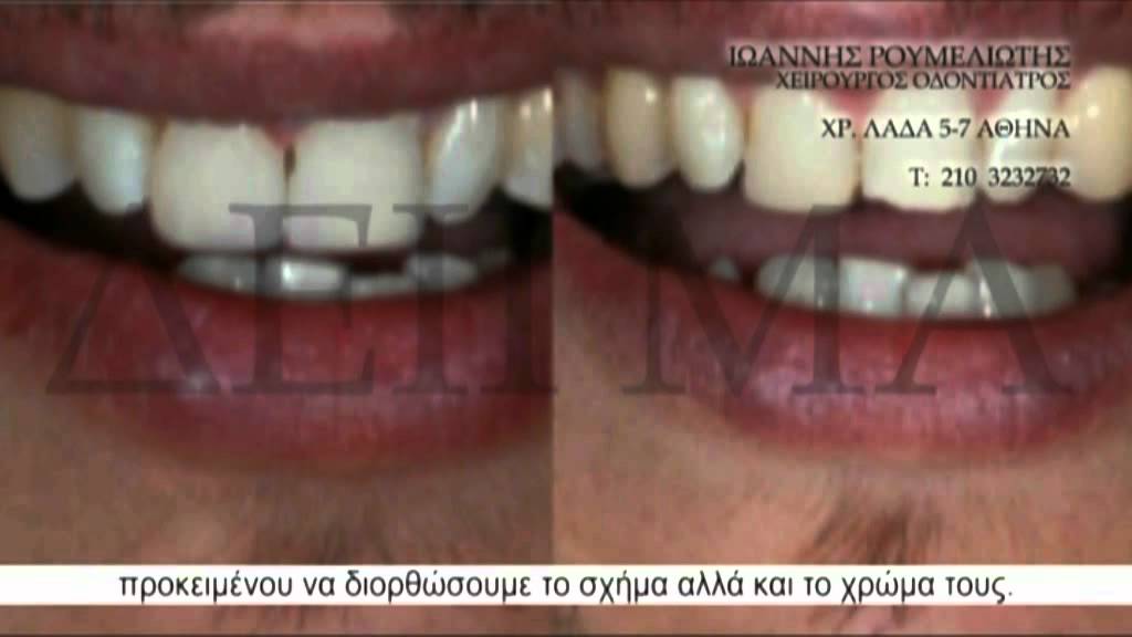 Αισθητικη Οδοντιατρική - video oδοντιατρειου - YouTube