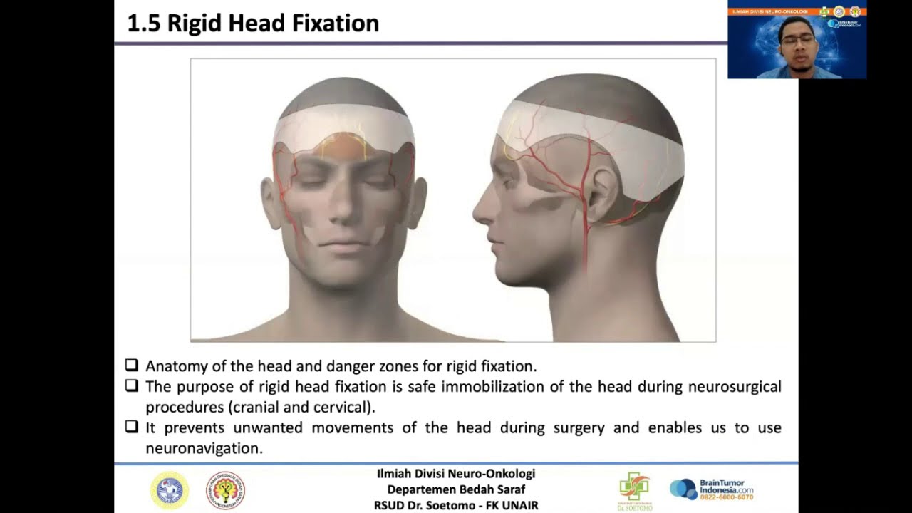 LIBAS "The Craniotomy Atlas: Basics" Departemen Bedah Saraf FKUA RSUD ...