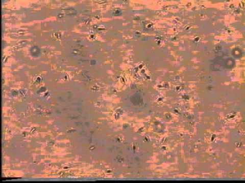 Sprem motility