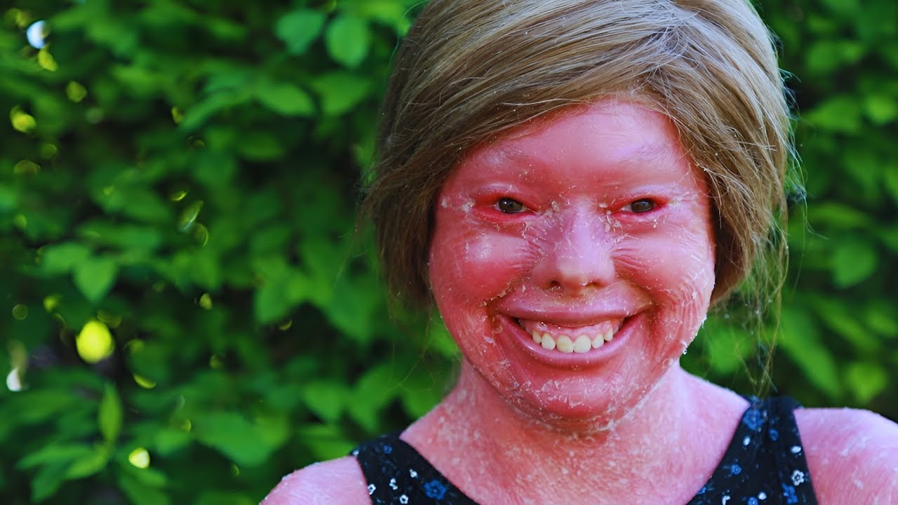 The 10 MOST Unusual People With Very Bizarre Skin Conditions - YouTube