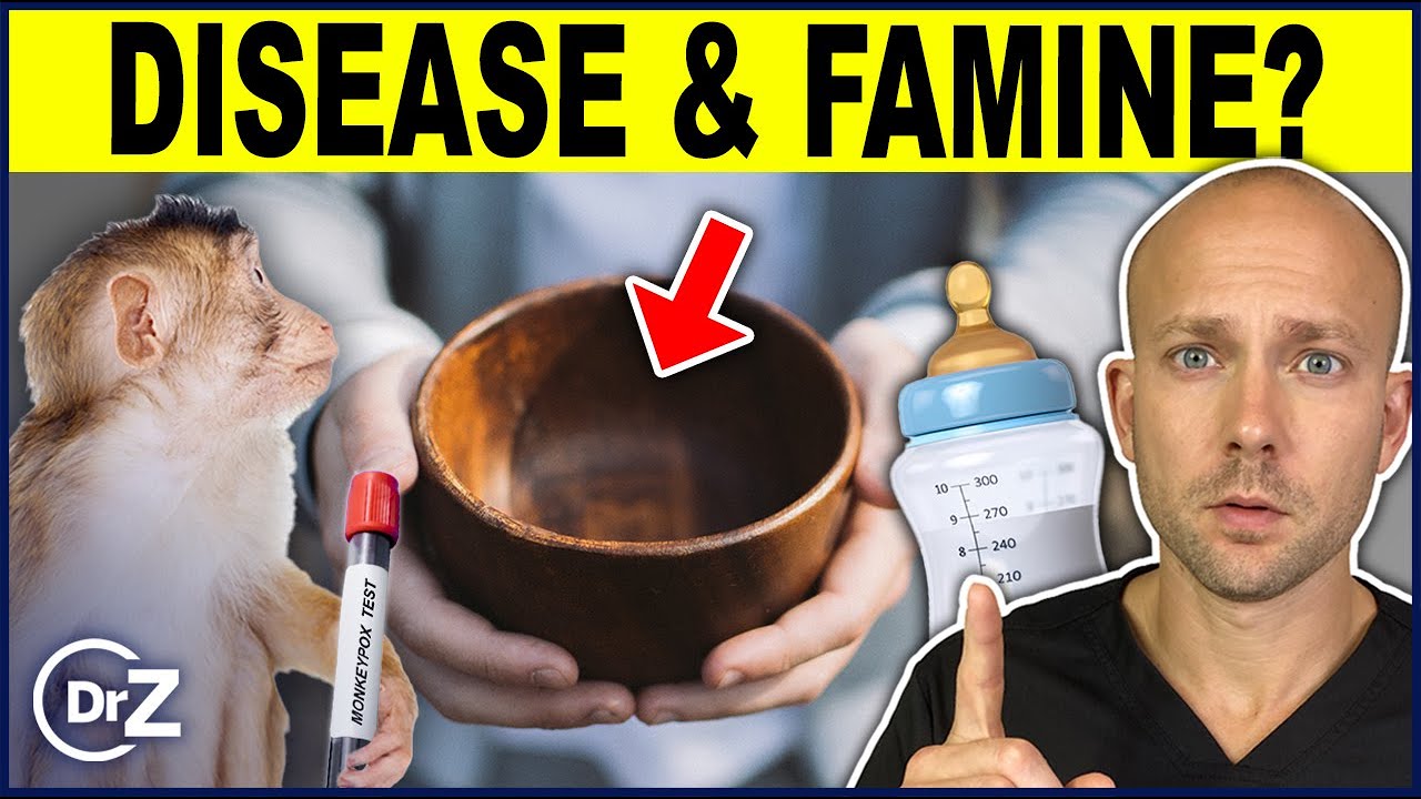 Breaking Health News: Monkeypox & Food Shortages Create Panic - YouTube