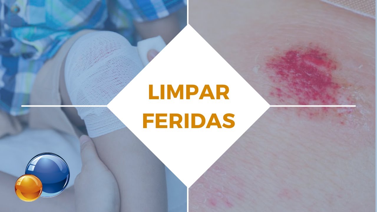 Limpar feridas: como fazer? - YouTube