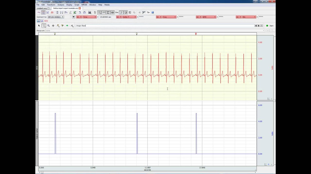 Noldus Observer XT Import/Export in AcqKnowledge 4.3 - YouTube