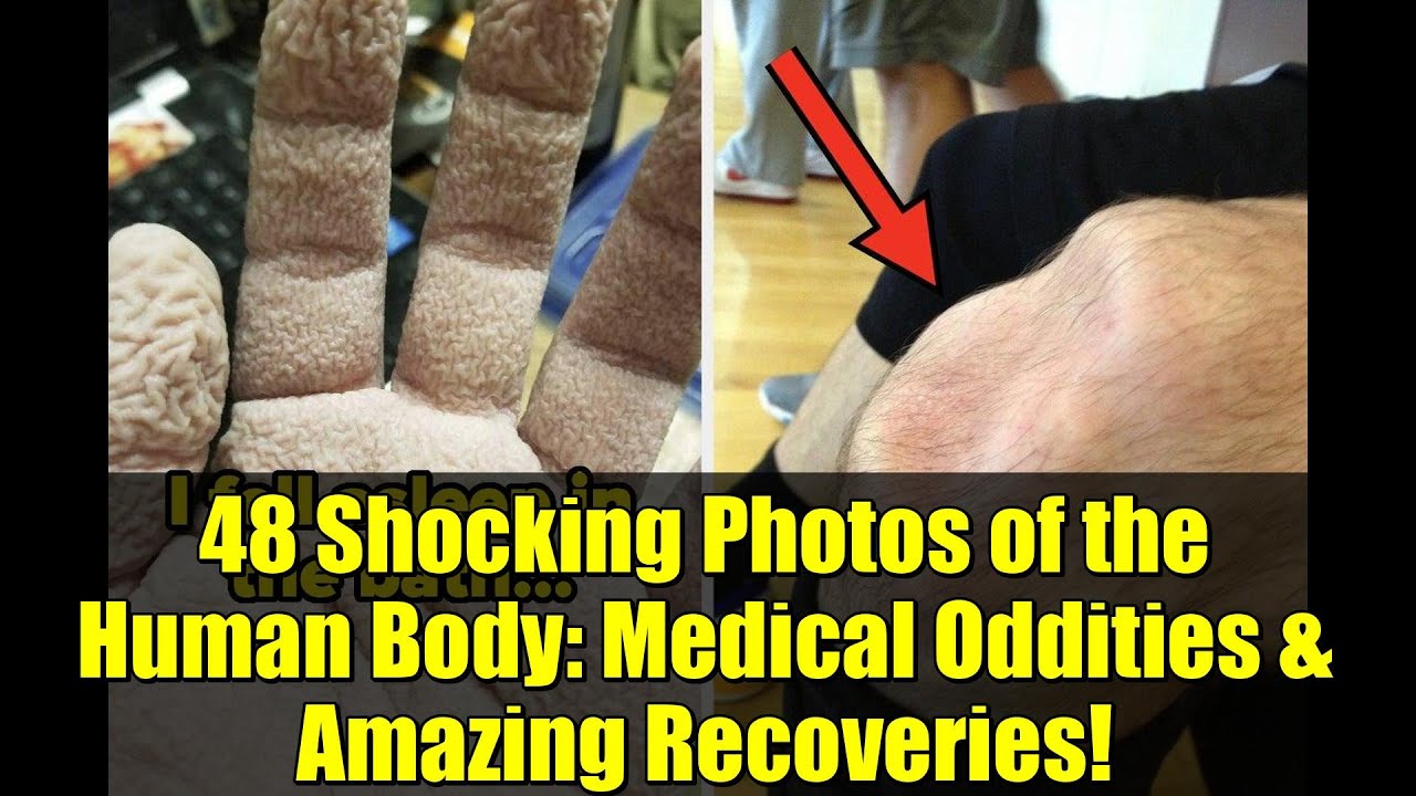 48 Shocking Photos of the Human Body: Medical Oddities & Amazing ...