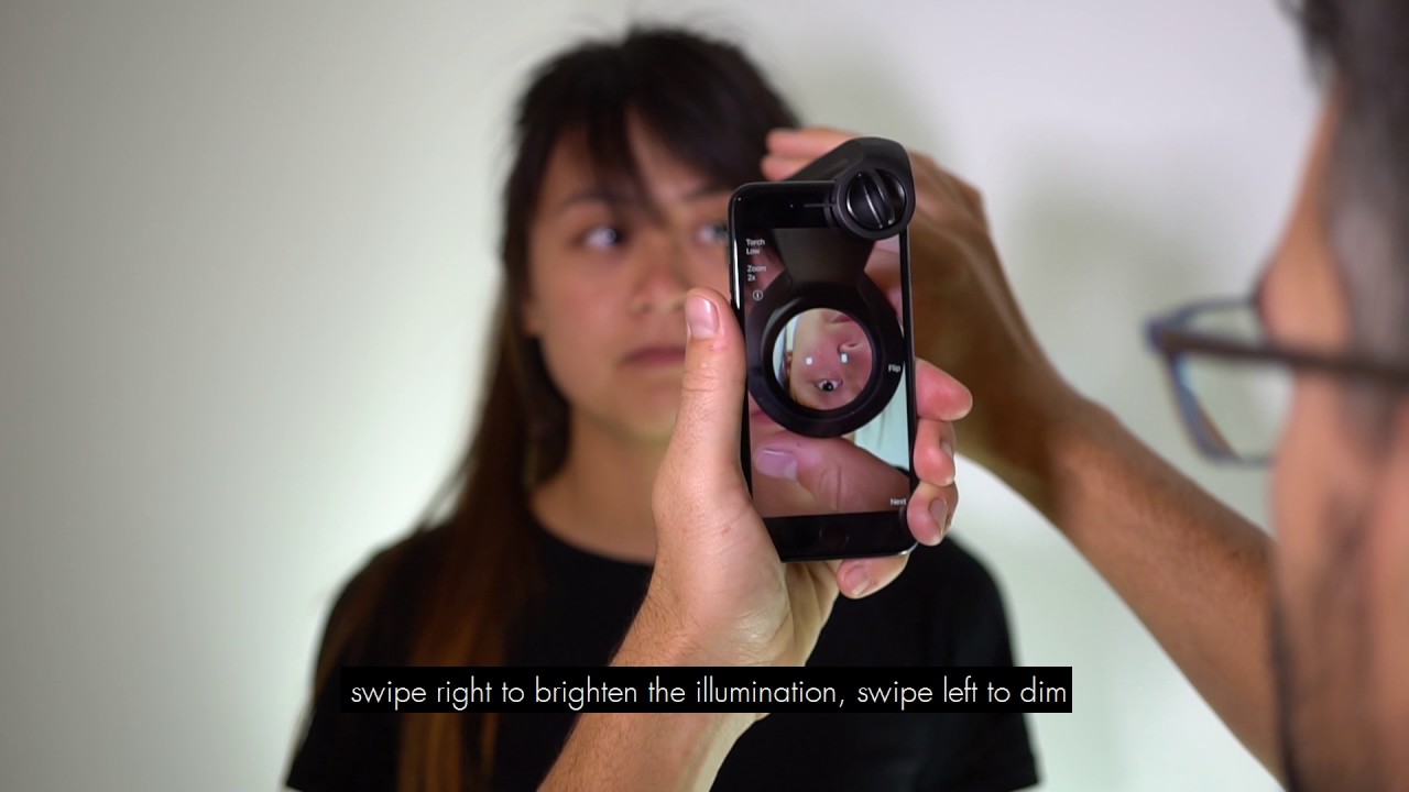 visoScope Smartphone Ophthalmoscope User Instruction - YouTube
