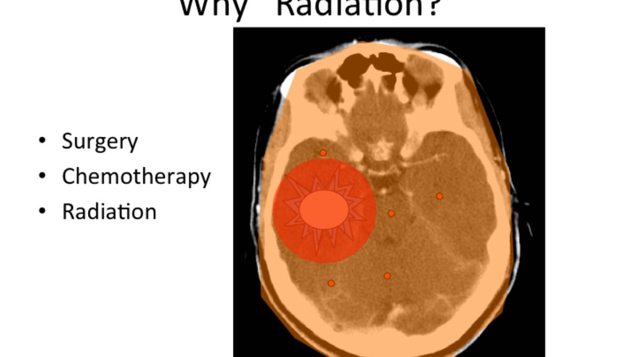 Lecture 1 - Introduction to Radiation Oncology - YouTube