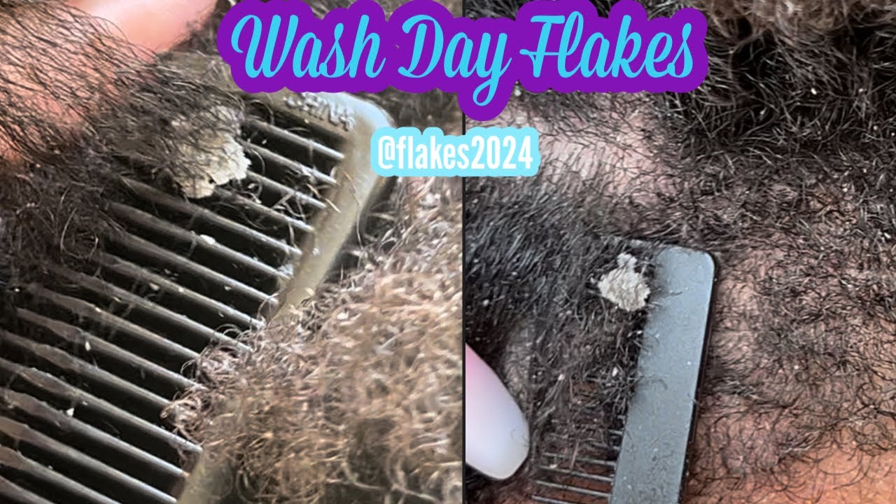 Happy Saturday🩵 | Wash Day | Itchy Scalp #youtube #youtuber #video # ...