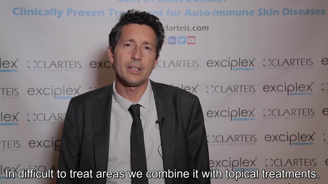 Exciplex® Testimonials - Dr. Pr. Thierry Passeron - YouTube