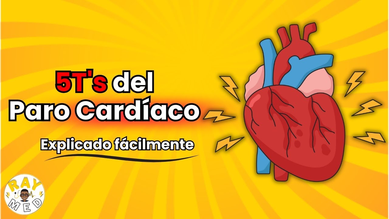 Domina las 5T del paro Cardíaco en solo 5 minutos! - YouTube