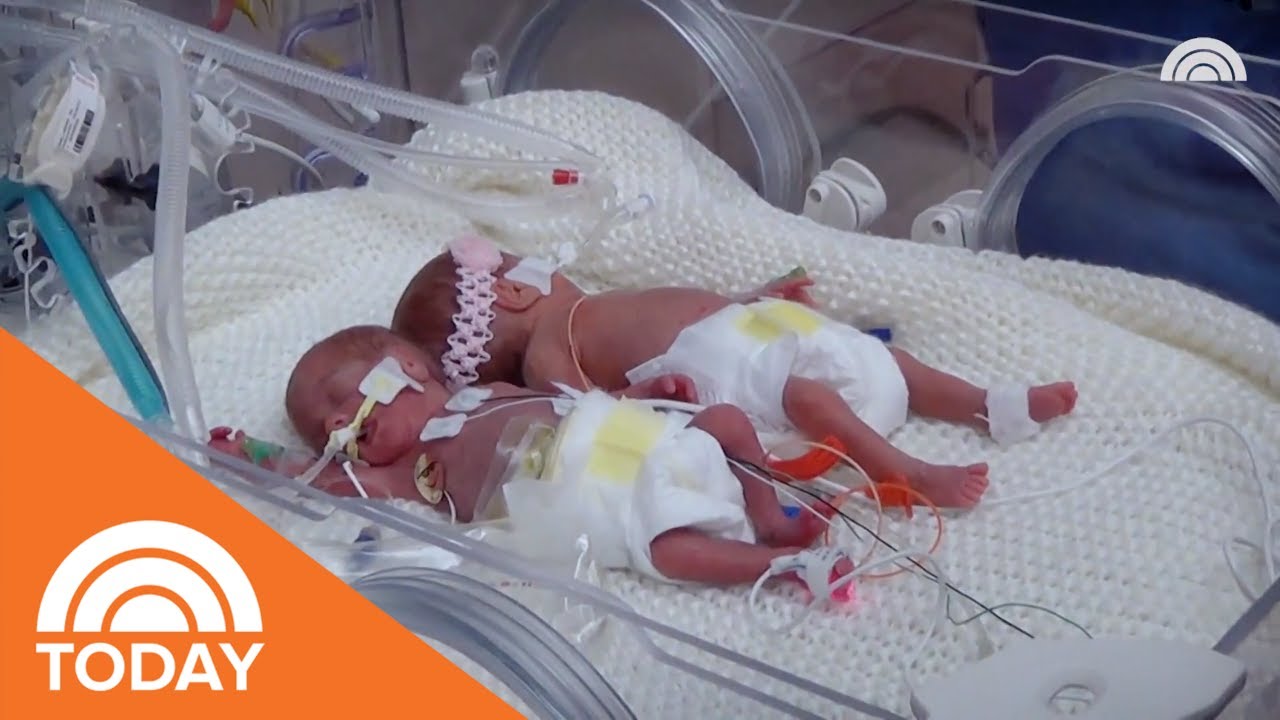 Parents Who Lost 2 Triplets Live With Love And Loss: 'I Think Of Them ...