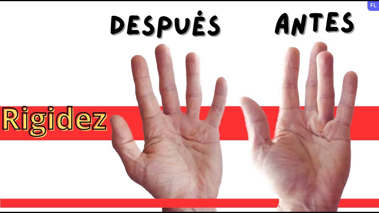 Así se siente la rigidez en las manos 🙌 - YouTube