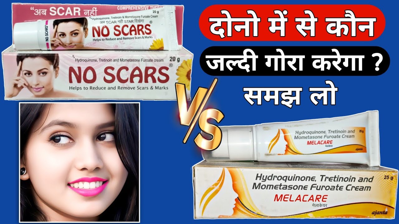 Melacare v/s No Scars Cream | गोरा होने वाला क्रीम | Gora Hone Wala ...