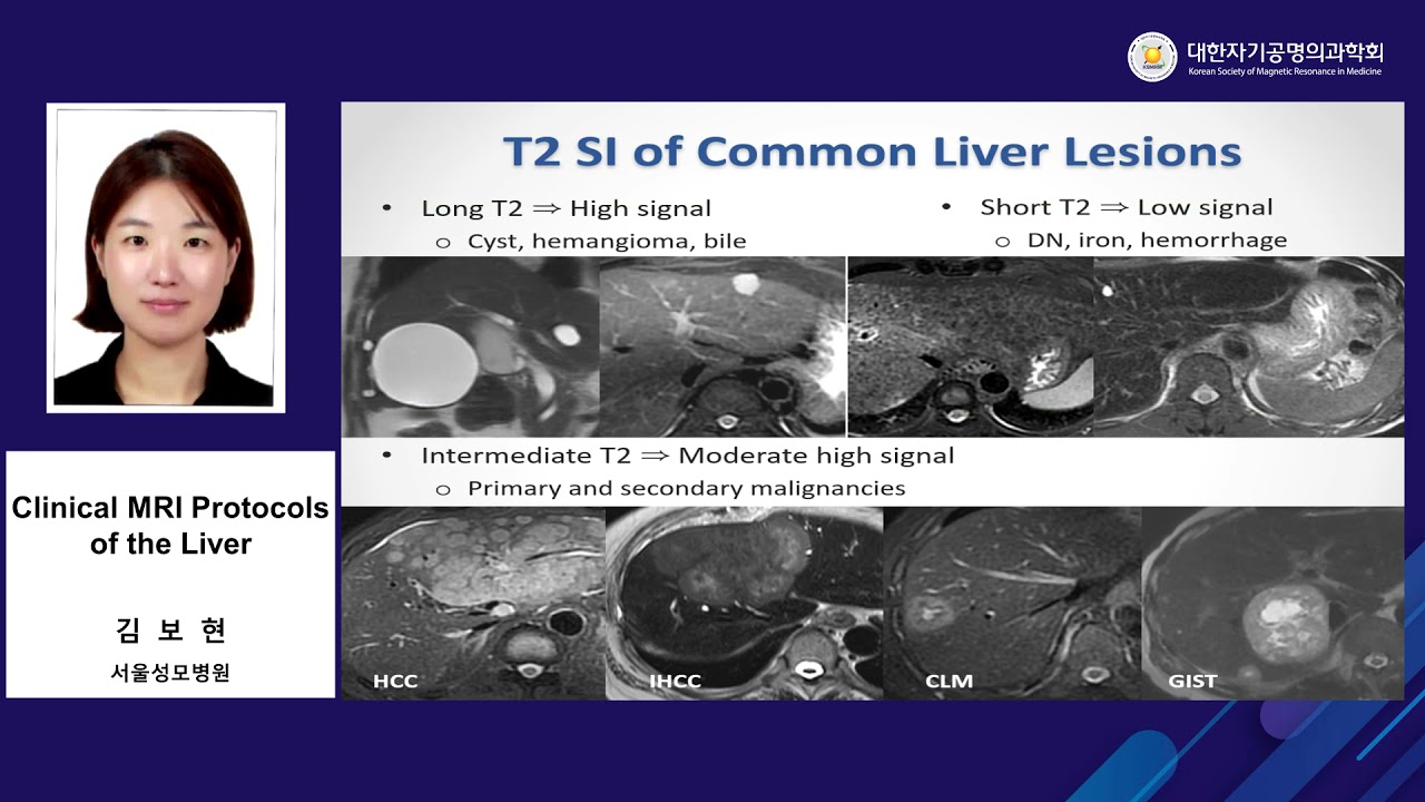 Lecture 07. (복부) Clinical MRI Protocols of the Liver - YouTube
