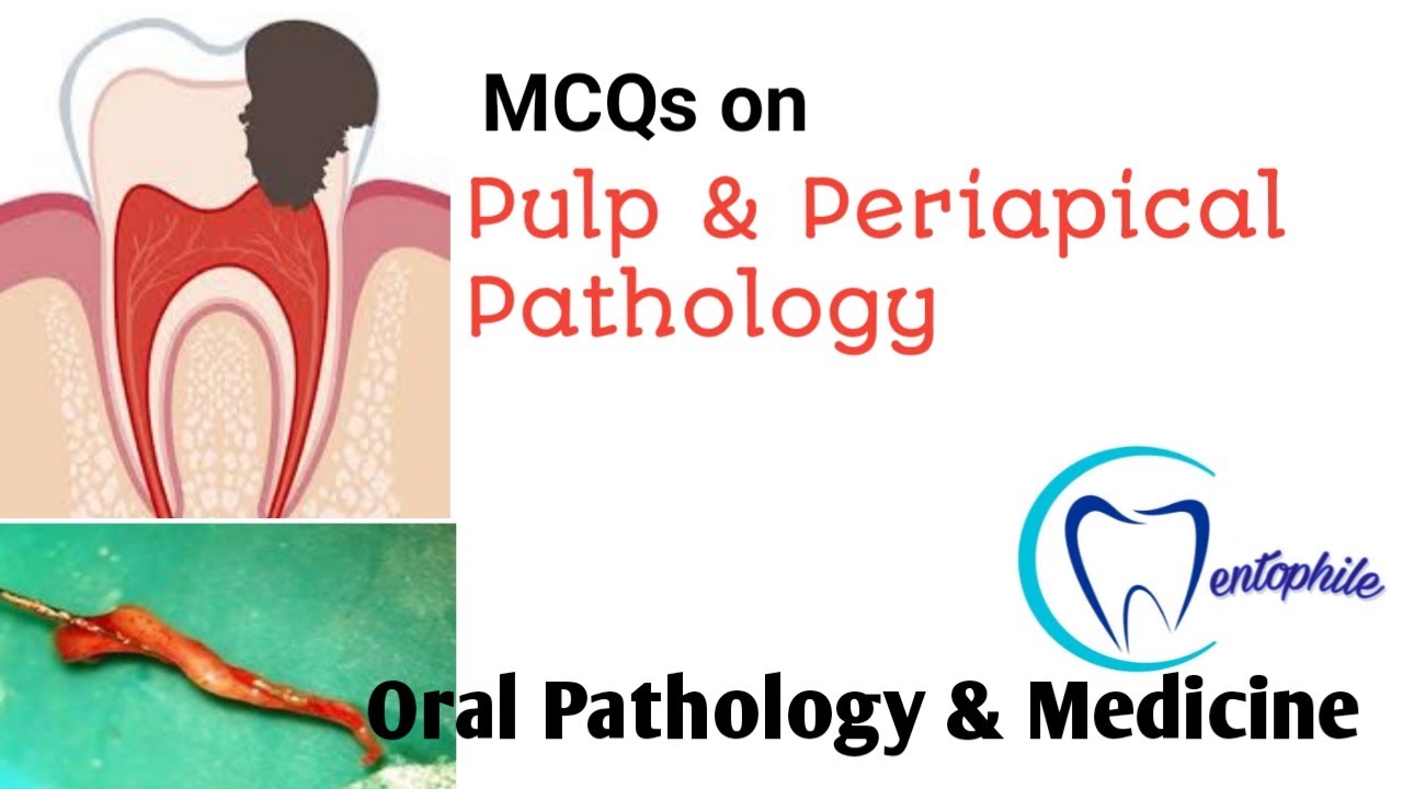 MCQs on Pulp & Periapical Pathology || Oral Pathology & Medicine ...