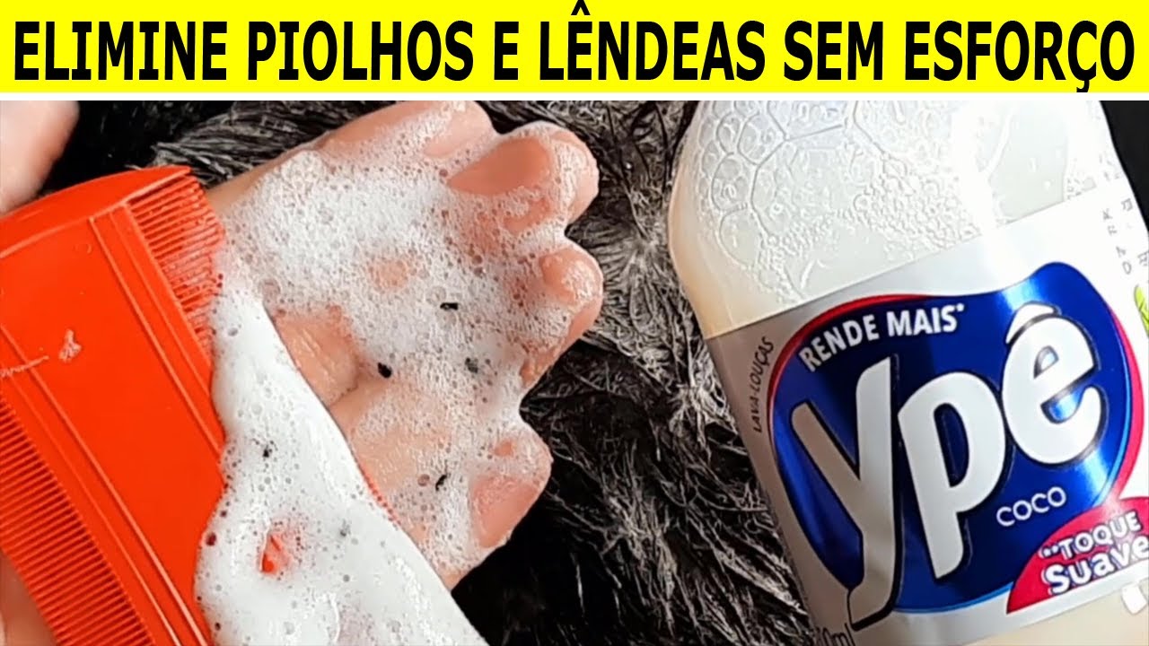 Qual O Melhor Veneno Para Matar Piolho De Cobra - FDPLEARN