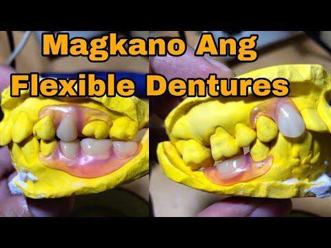 How Much Is Flexible Dentures In The Philippines