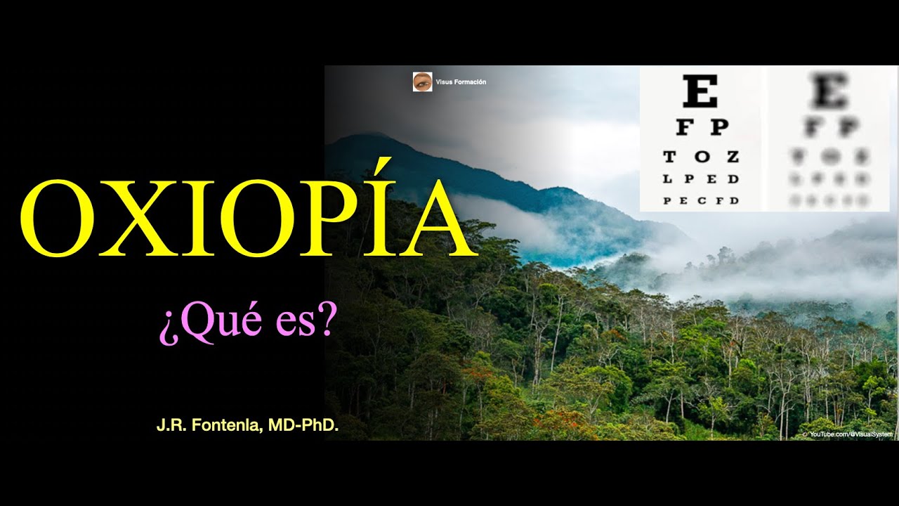 ¿Qué es la Oxiopía, Iso-Oxiopía y Aniso-Oxiopía?. - YouTube