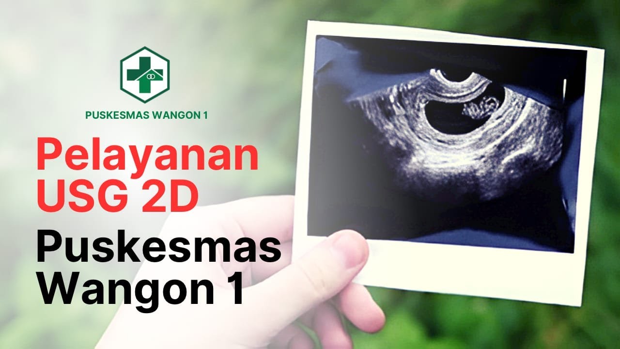 Pelayanan USG 2D Puskesmas Wangon 1 - YouTube