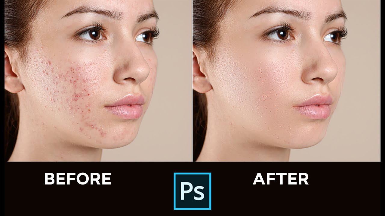 Skin Retouching; Face Smooth - Photoshop - YouTube