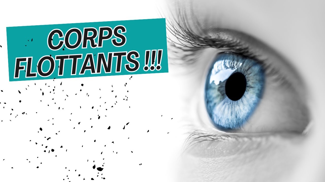Adieu Corps Flottants, Mouches Volantes, Points Noirs : 4 étapes pour ...