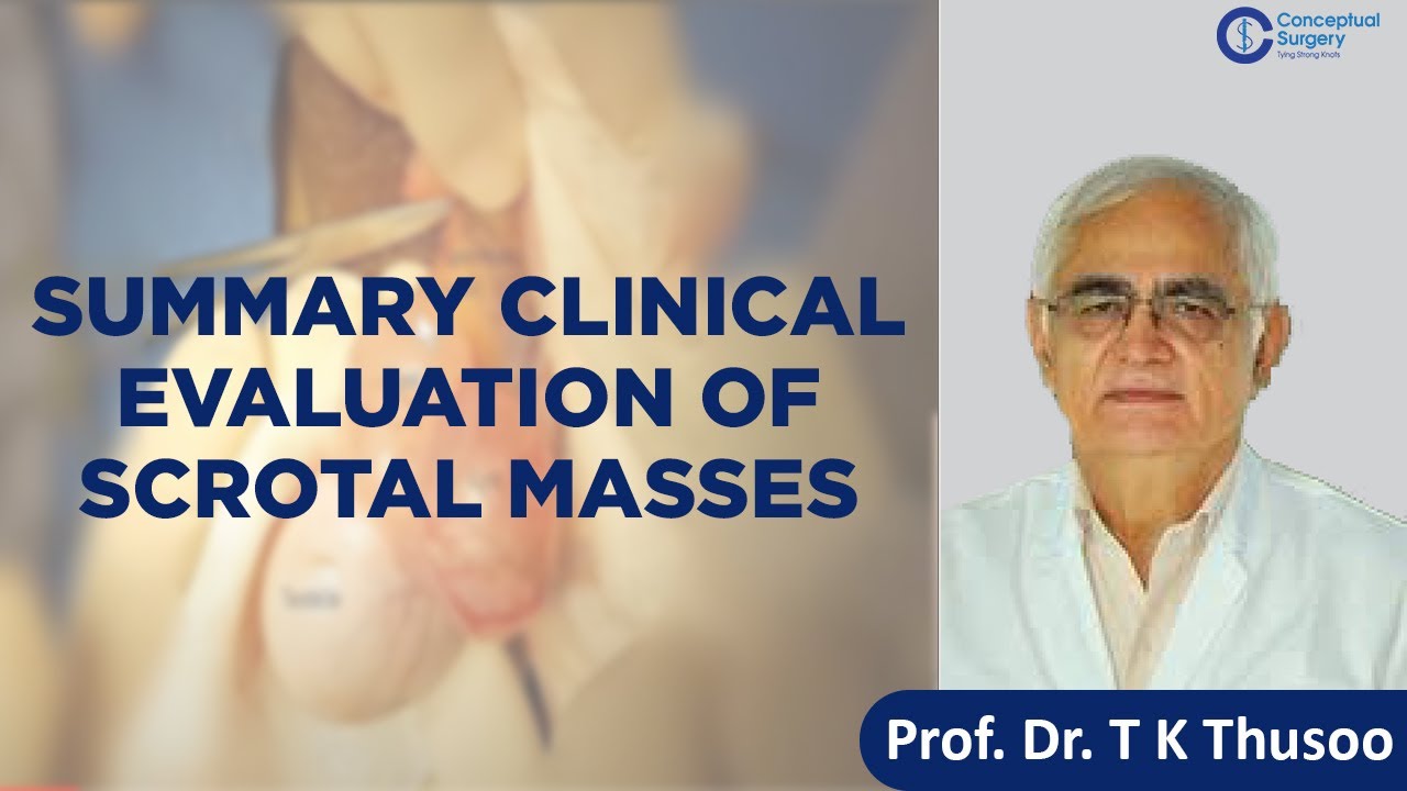 Summary of Clinical Evaluation of Scrotal Masses by Prof. Dr.T K Thusoo ...