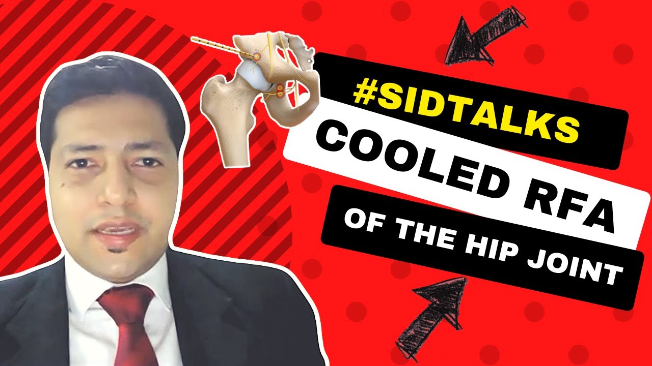 Cooled Radio Frequency Ablation (RFA) of the Hip Joint #SIDTALKS - YouTube