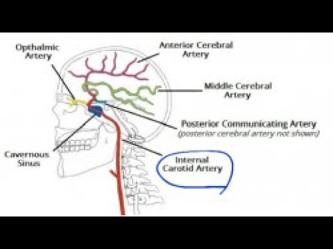 Anatomy of the internal carotid artery ; Origin, Course and termination ...