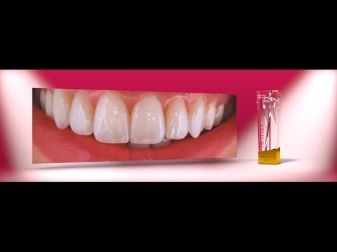 IPS e.max Smile Award 2016 - YouTube