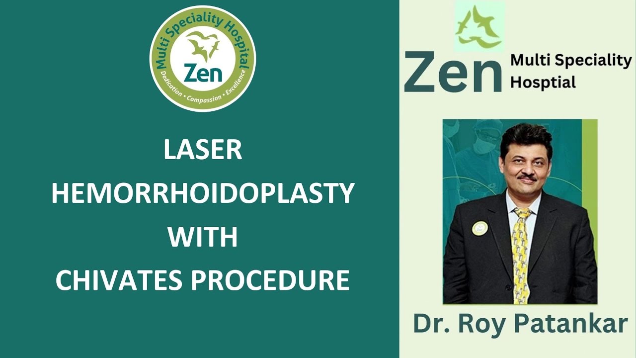 Laser Hemorrhoidoplasty with Chivates Procedure - Dr. Roy Patankar ...