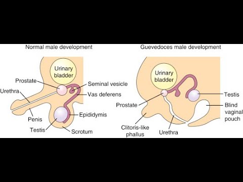 Differences between Female pseudohermaphroditism And Male ...