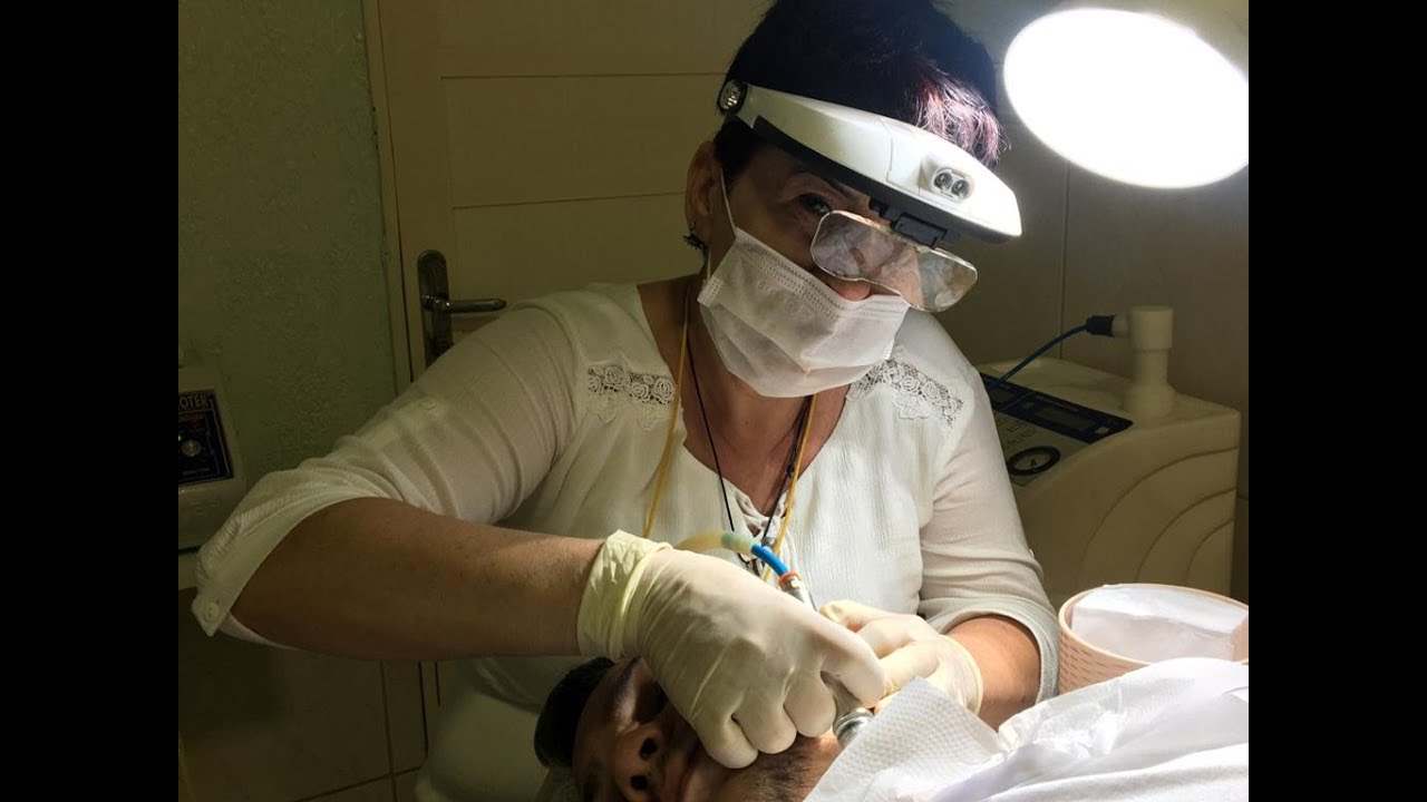 Limpeza de pele - Comedões abertos e fechados - YouTube