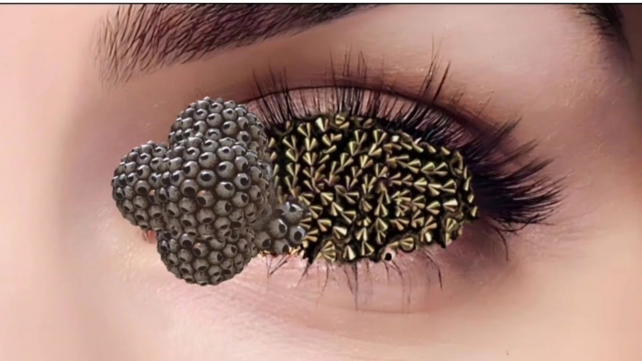 ASMR Remove Fleas & Dog Ticks Infected Eyes | ASMR Treatment Animation ...