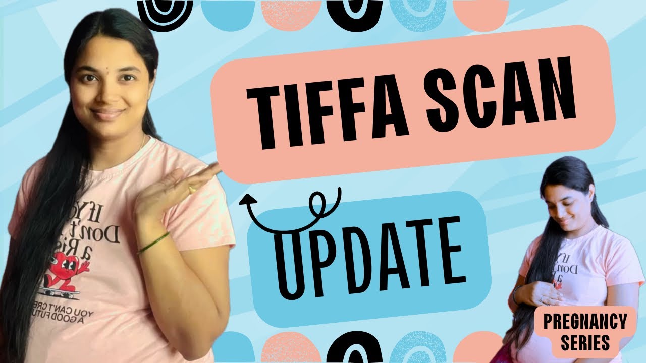 TIFFA SCAN UPDATE || 2nd TRIMESTER SCAN || baby 2 || pregnancy series ...