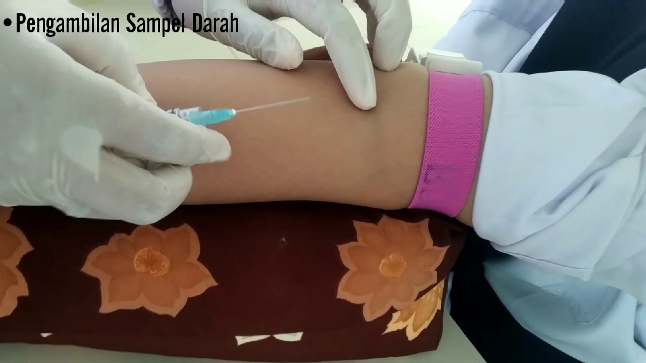 [HEMATOLOGI] PEMERIKSAAN HEMOGLOBIN METODE SAHLI BY KELOMPOK 3 - YouTube